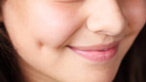 How to Get Dimples Permanently Without Surgery – Is It Possible? - Ito ...