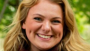 How to Get Dimples Permanently Without Surgery – Is It Possible? - Ito ...