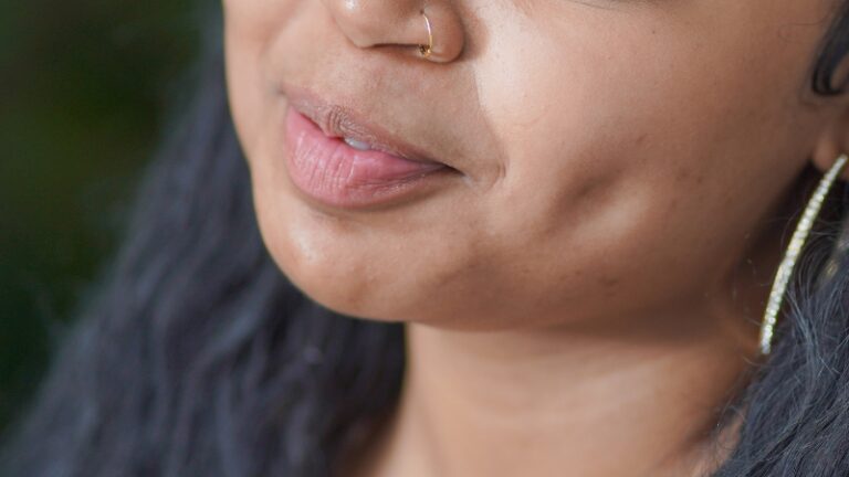 How to Get Dimples Permanently Without Surgery – Is It Possible? - Ito ...